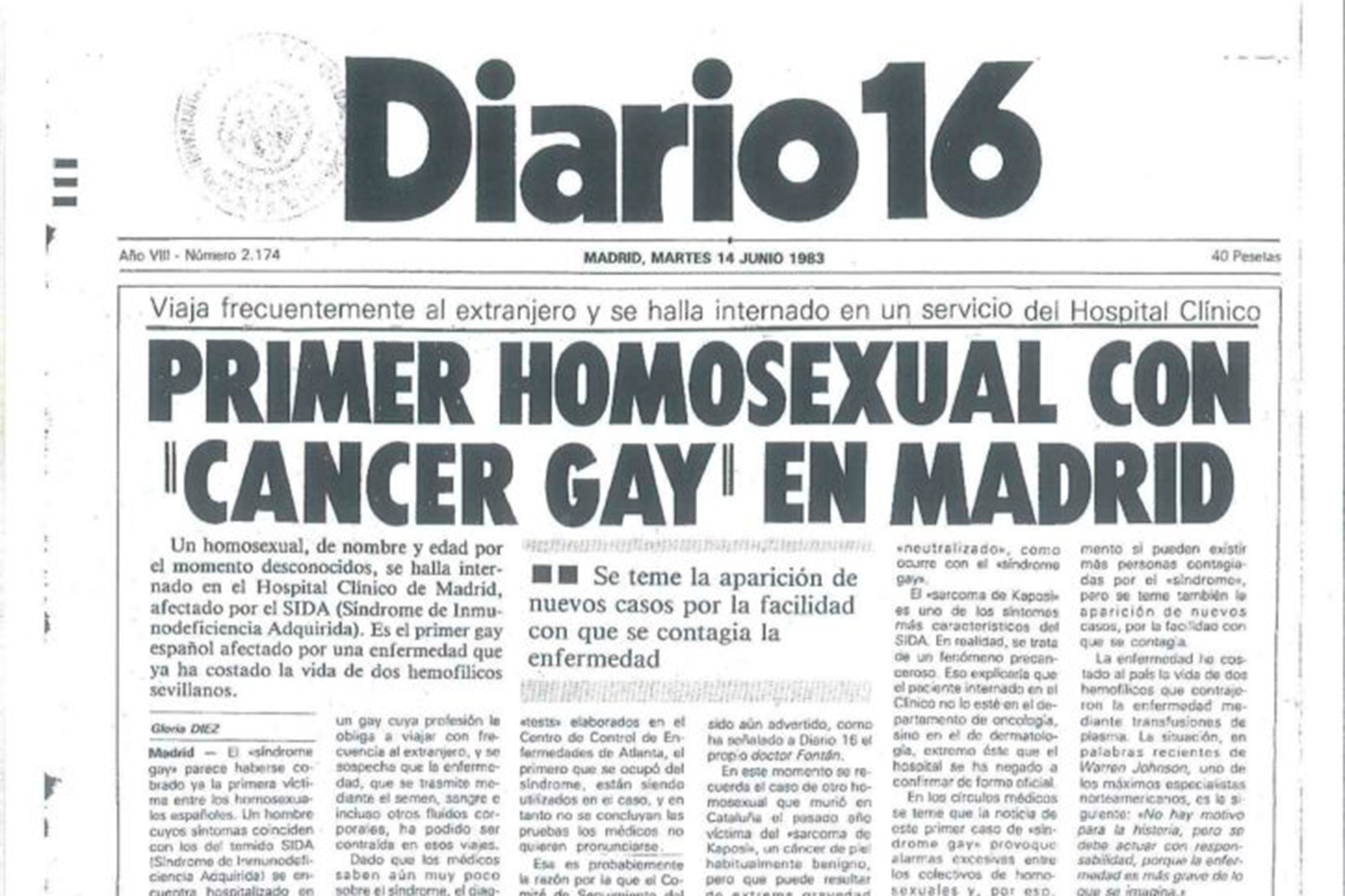 40 Años Del Primer Caso De Sida En España Eresvihda