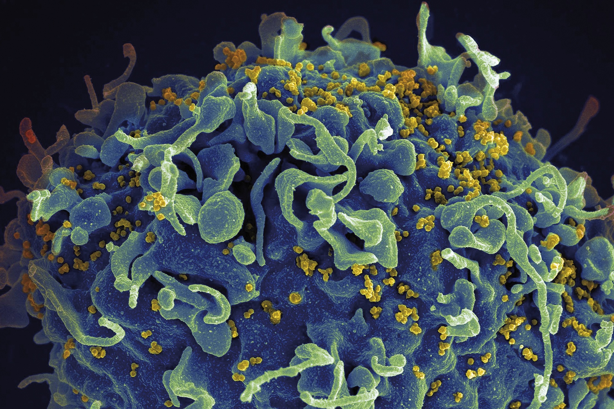 Un reservorio viral más bajo, posible camino para curar el VIH - EresVihda