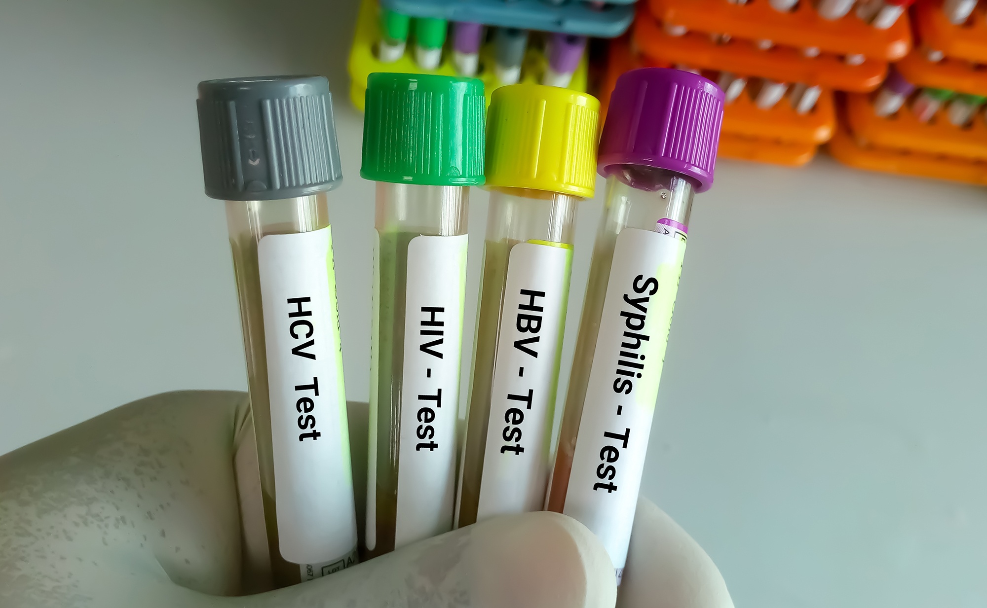 Nueva guía de la OMS sobre VIH, hepatitis e ITS - eresVIHda