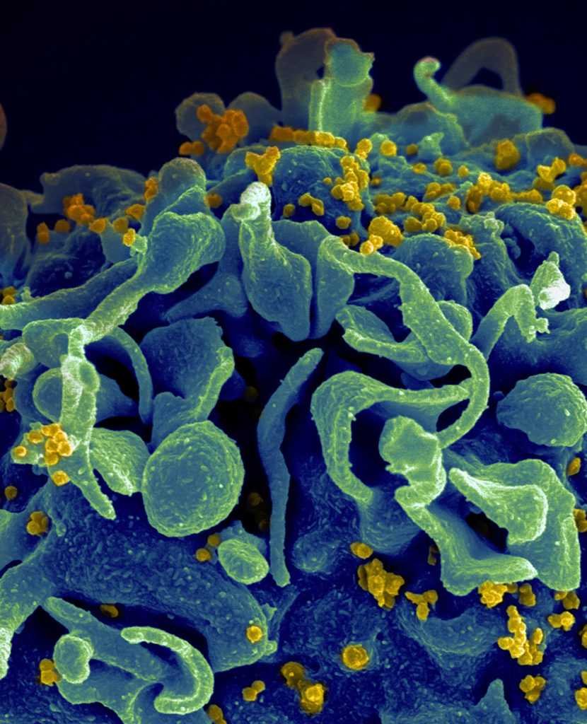 Una nueva técnica no invasiva logra detectar los reservorios del VIH