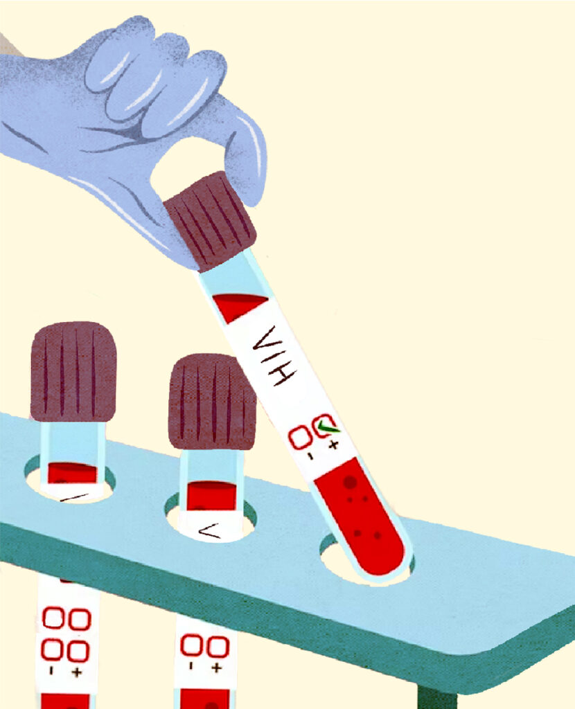 El diagnóstico tardío del VIH complica la efectividad del tratamiento - eresVIHda