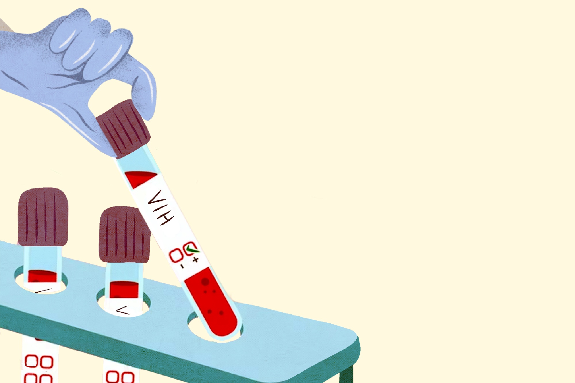 Vih Positivo Y Embarazo