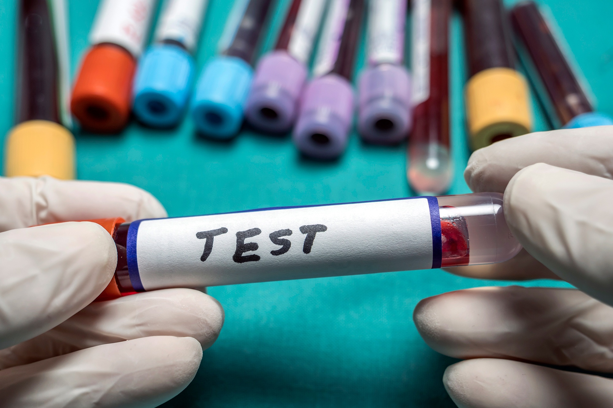 Pruebas y más pruebas contra las ITS - eresVIHda